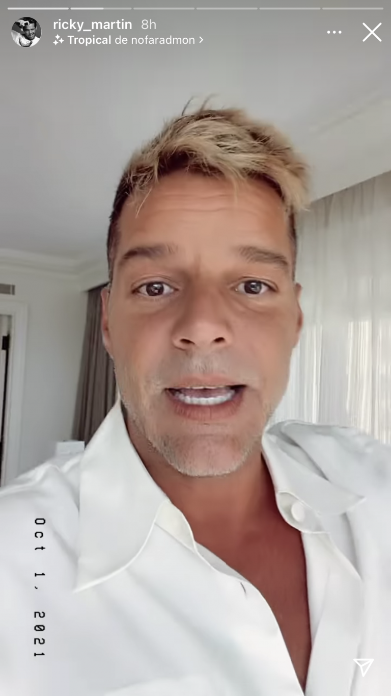 Ricky Martin responde ante las críticas de su rostro